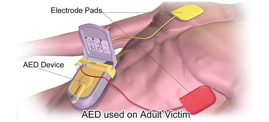 First Aid Basics - OSHA Outreach Courses first-aid OSHA OSHA outreach
